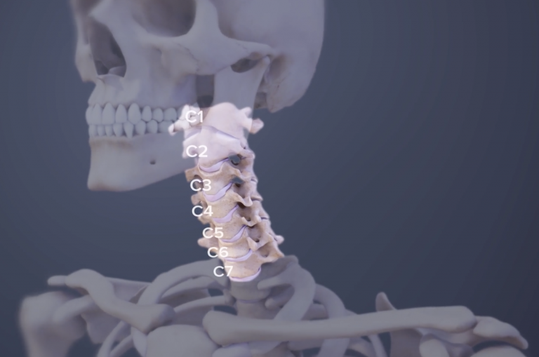 Columna cervical | Patologias | Dr Alberto Marqués